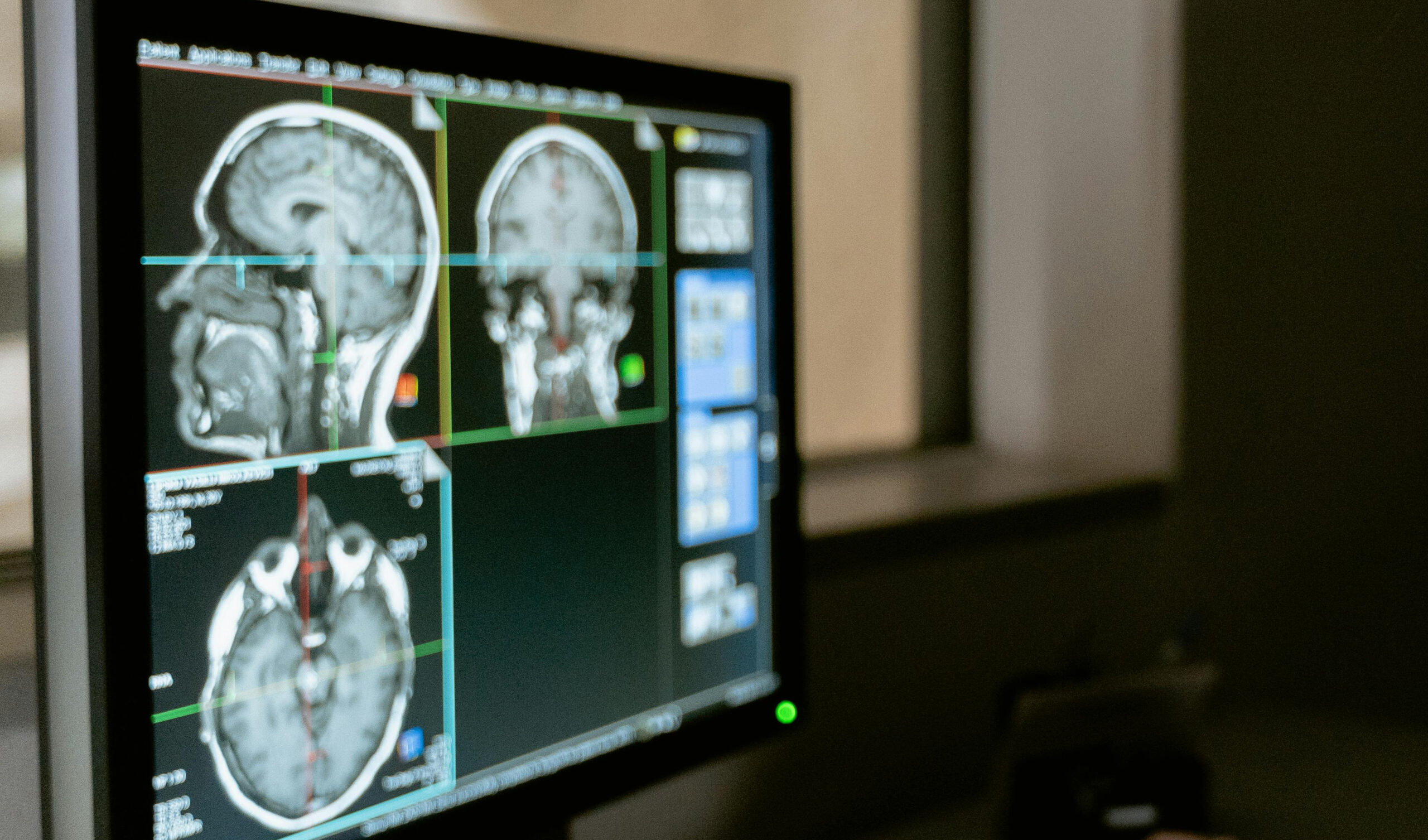 Absence au travail durant les 12 mois suivant un traumatisme crânien ...